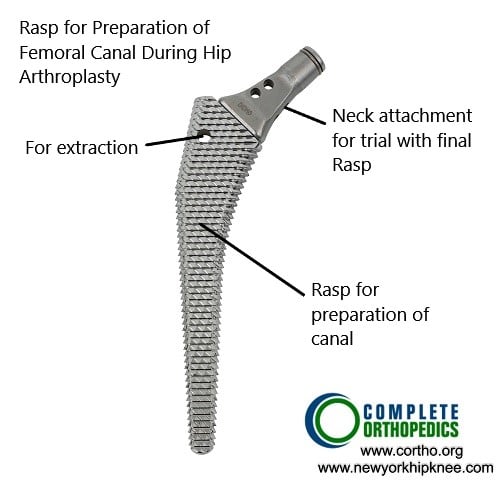 Robotic Hip Replacement - Dr. Nakul Karkare | Top NY Surgeon