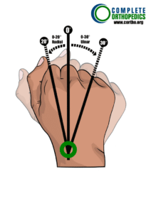 Workers compensation Scheduled Loss of Use for Hand and Wrist | Best ...